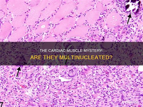 The Cardiac Muscle Mystery Are They Multinucleated Cyvigor