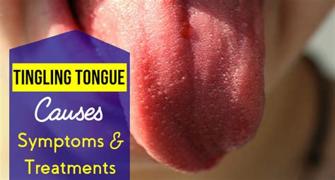 Tingling Tongue Causes Symptoms And Treatments Allergy