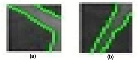 Segmentation Of Fig 6b D After 100 Iterations Using The Proposed Download Scientific Diagram