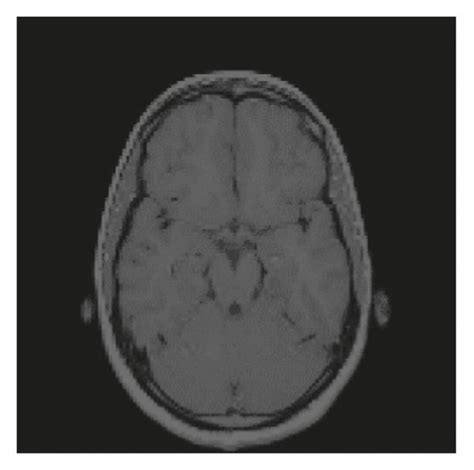 Discrete Fourier Transform Of The Medical Image A Original Medical Download Scientific