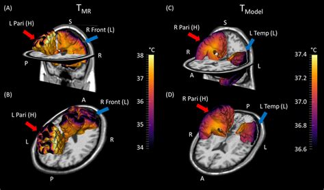 Lobar Scale 3d Images Overlaid With Ab Mr Measured And Cd