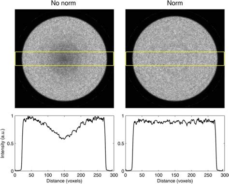 Before And After Normalization Correction Left To Right For Image Download Scientific Diagram