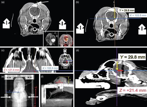 Brain Biopsy Techniques Veterian Key
