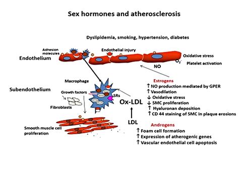Gender Differences And Atherosclerosis Fgu