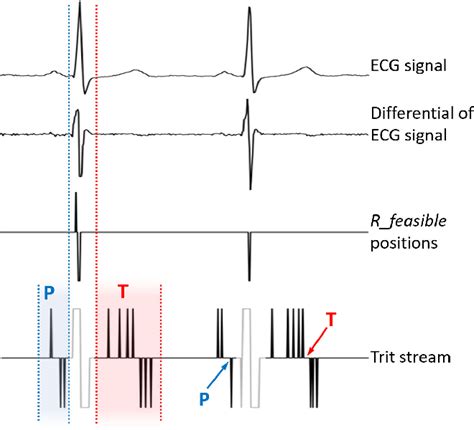 Figure 1 From An Efficient Ecg Classification System Using Resource