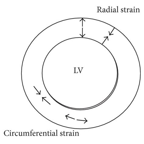 Radial Strain And Circumferential Strain Af Radial Strain