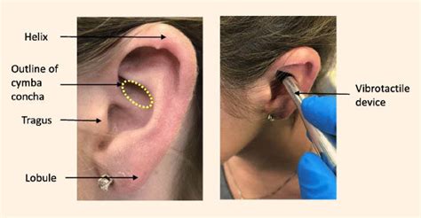 Vagus Nerve Stimulation Via The Outer Ear Takes Center Stage