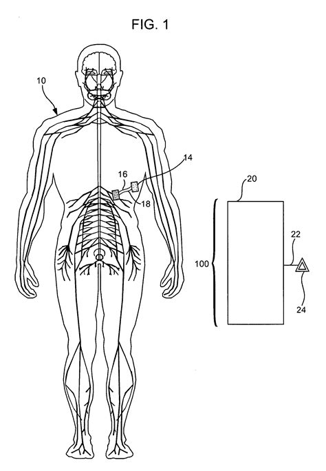 Autonomic Nervous System Patented Technology Retrieval Search Results Eureka Patsnap