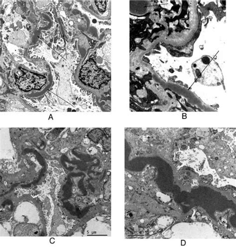 Electron Microscopy Reveals An Interrupted Band Pattern Of Extremely Download Scientific