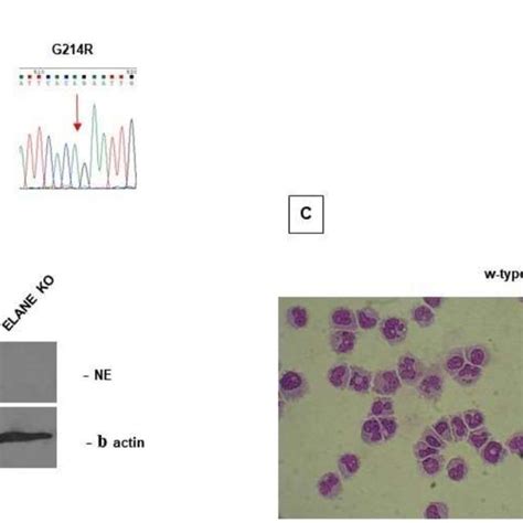 Elane Knock In Ki And Knock Out Ko Hl60 Cell Lines A