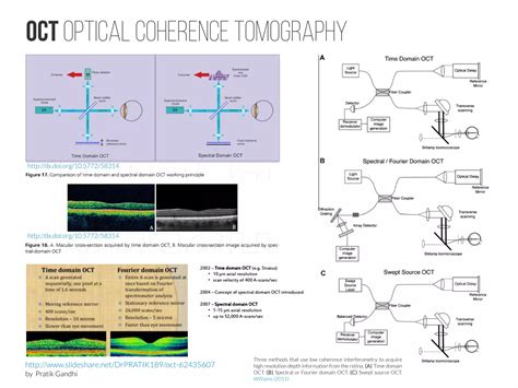Shallow Introduction For Deep Learning Retinal Image Analysis Pdf Eye And Vision Conditions