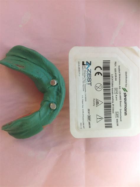 Photo Gallery Implant Retained Denture Facial Surgery UK