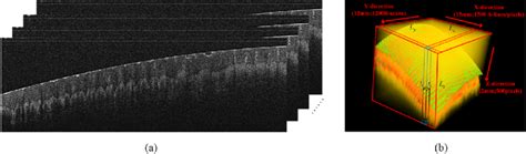 A A Series Of B Scans Of Oct Volume Data B An Example Of Oct