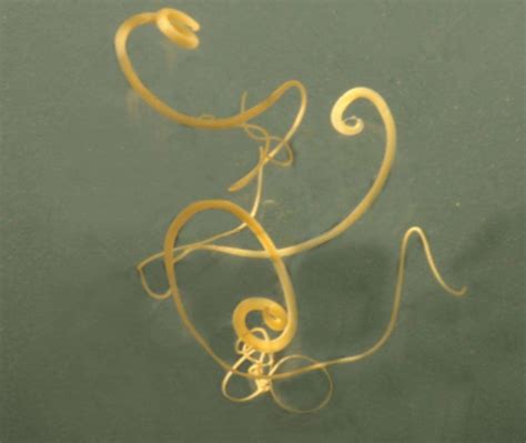 The Big 5 ID Through Hookworms Alyssa Flashcards Quizlet