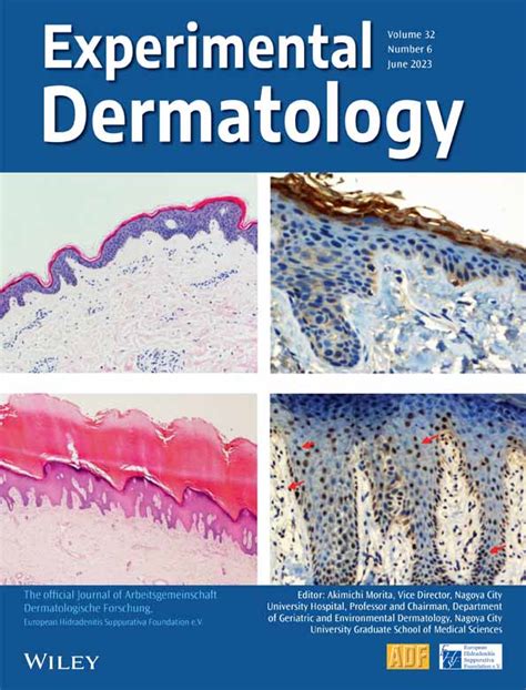 Distinct Skin Microbiome Modulation Following Different Topical Acne Treatments In Mild Acne