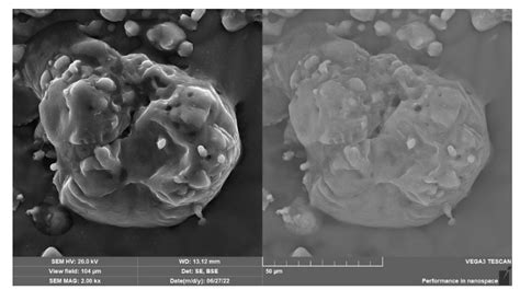 Analysis Of The Effect Of Ultra Fine Cement On The Microscopic Pore