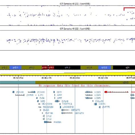 Image Of The 16q243 Duplication Identified By Snp Array Analysis