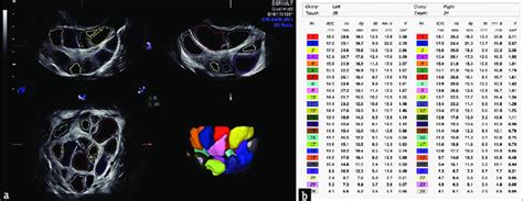 A The Image Of An Ovary In Three Orthogonal Planes X Y And Z And Download Scientific