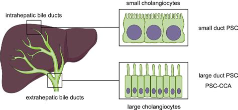 Figure 2 From Cholangiocytes In The Pathogenesis Of Primary Sclerosing