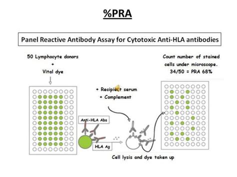 Organ Transplantation And The Hla System Lecture Pptx Genetics Science