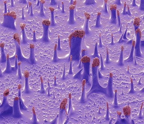 Stink Bug Egg Detail Sem Stock Image C0579346 Science Photo Library