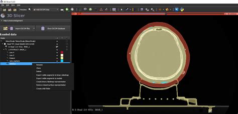 Exploring Vtk Based 3d Modeling Of Floating Point Rtstruct Contours In 3d Slicer Support 3d