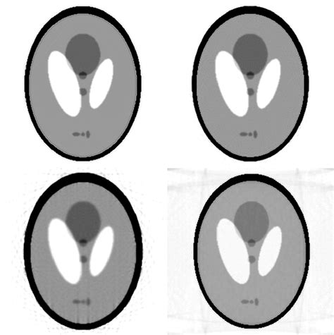 Reconstructions Of The Shepp Logan Head Phantom On A 256 2 256 Pixel