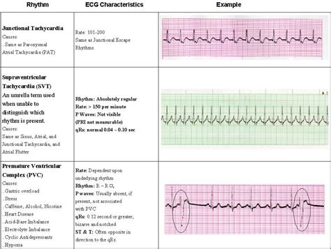Pin By Saving American Hearts Inc On Saving American Hearts Inc Aha Acls Bls Pals
