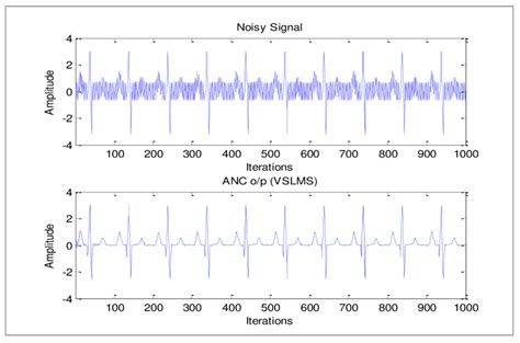 matlab simulation for vslms algorithm download scientific diagram