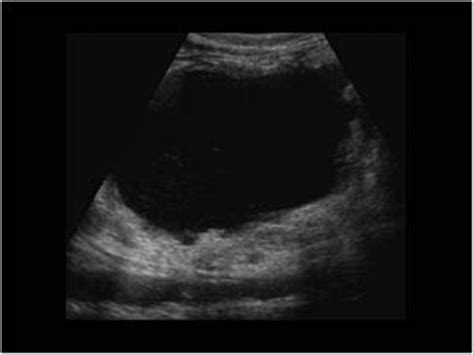 Abdomen And Retroperitoneum 1 3 Pancreas Case 1 3 6 Pancreatic