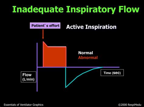 Ppt Ruben D Restrepo Md Rrt Faarc Professor Powerpoint