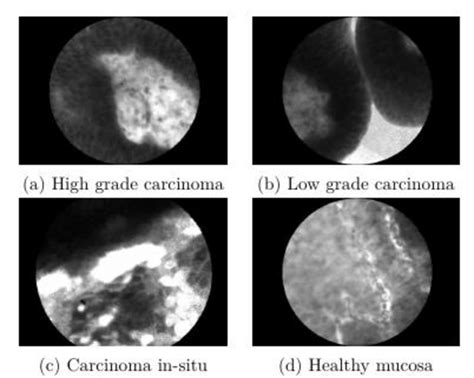 Example Of Each Class From Cystoscopy Data Set Download Scientific