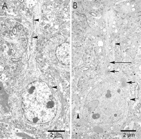 Electron Micrographs Of Pyramidal Neurons In The Cerebral Cortex Of A Download Scientific