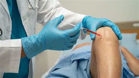Prp Injection Complications Are They Worth It