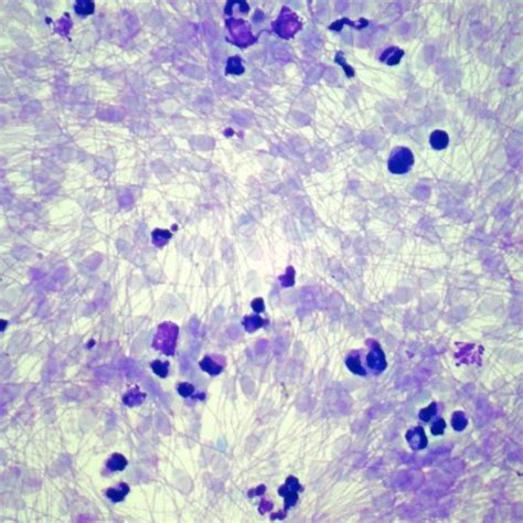 Pdf Pathogenesis Of Brucella Spp