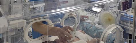 Diagnosis Of Neonatal Lung Diseases The Era Of Lung Ultrasound Replacing Of Chest X Ray Has Arrived