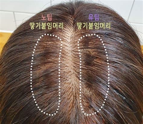 보다 자연스러운 노팁붙임머리 아스카헤어에서 만나요 네이버 블로그