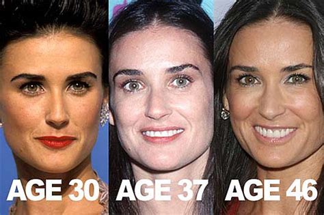 Demi Moore Plastic Surgery Before And After Nose Job And Botox Star