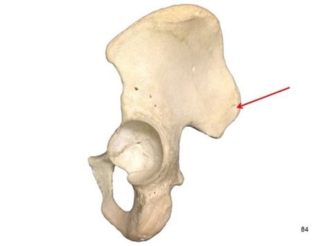 Chapter 8 Appendicular Skeleton Lab Images Flashcards Quizlet