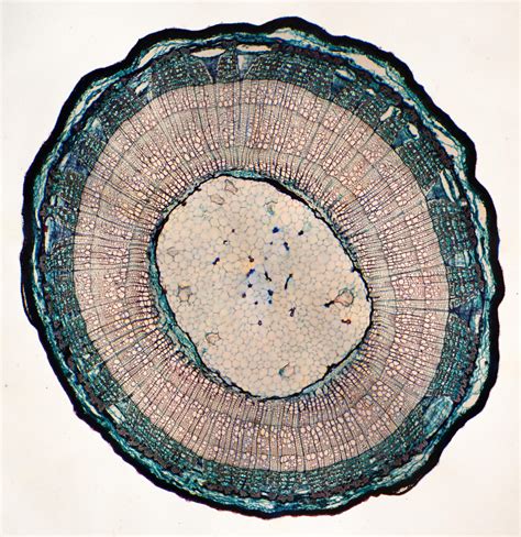 Xylem Cross Section The Photograph Shows A Cross Section Of A Root