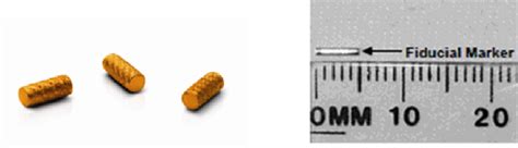 Figure 21 From Automatic Detection Of Fiducial Markers From Electronic