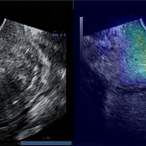 Visual Interpretation Of Cnns Through A Gradient Based Location Download Scientific Diagram