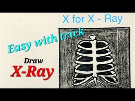 X Ray Drawing Easy How To Draw X Ray X For X Ray Skeletal System
