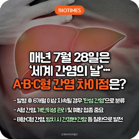 카드뉴스 매년 7월 28일은 ‘세계 간염의 날∙∙∙a∙b∙c형 간염의 차이점은 바이오타임즈