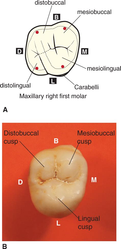 Type Traits That Differentiate Maxillary Second From First Molars Pocket Dentistry