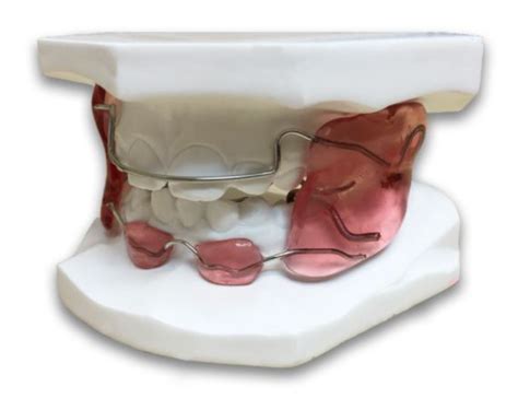 Orthodontics — S4s London