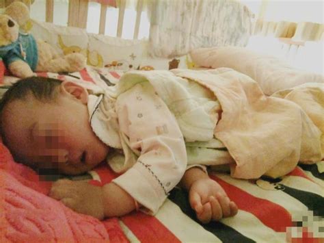 别让“腺样体面容”毁了孩子的颜值打鼾腺样体面容新浪新闻