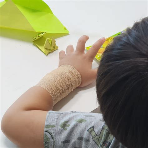 아기 농가진 초기 증상 유아 농가진 전염 연고 관리 방법 네이버 블로그