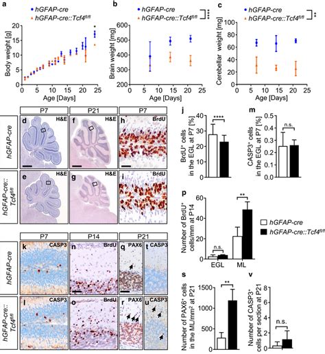 Prenatal Deletion Of Tcf4 Leads To Cerebellar Hypoplasia And Migration