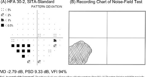 Figure 5 From Subjective Perception Of Visual Field Defects Using